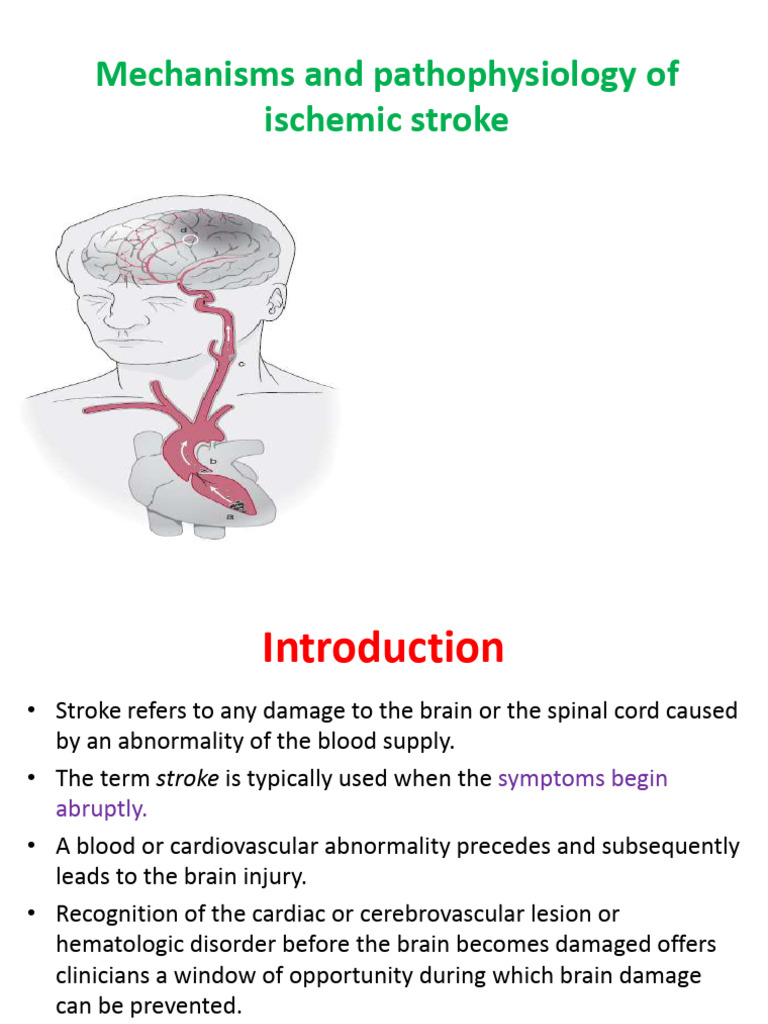 Strokepathophysiology 190918100702 | PDF | Stroke | Embolism