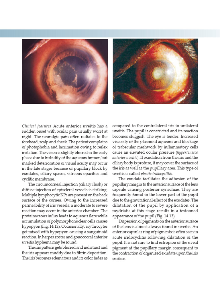 Nema - Textbook of Ophthalmology, 5th Edition-21 | PDF | Glaucoma | Eye