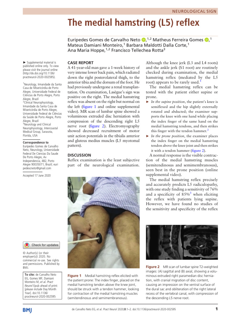 The Medial Hamstring (L5) Reflex | PDF | Knee | Neurology