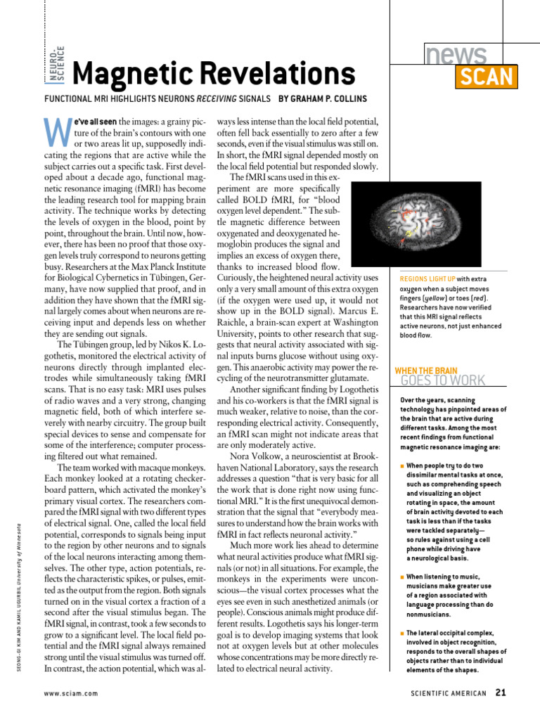 Collins 2001 | PDF | Functional Magnetic Resonance Imaging | Brain