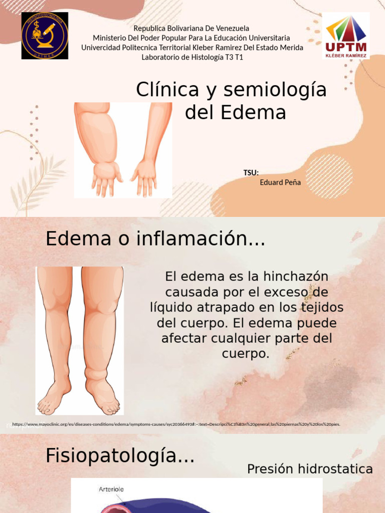 Edema | PDF