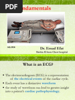 Delta Wave in ECG: WPW Insights | PDF | Cardiac Electrophysiology ...