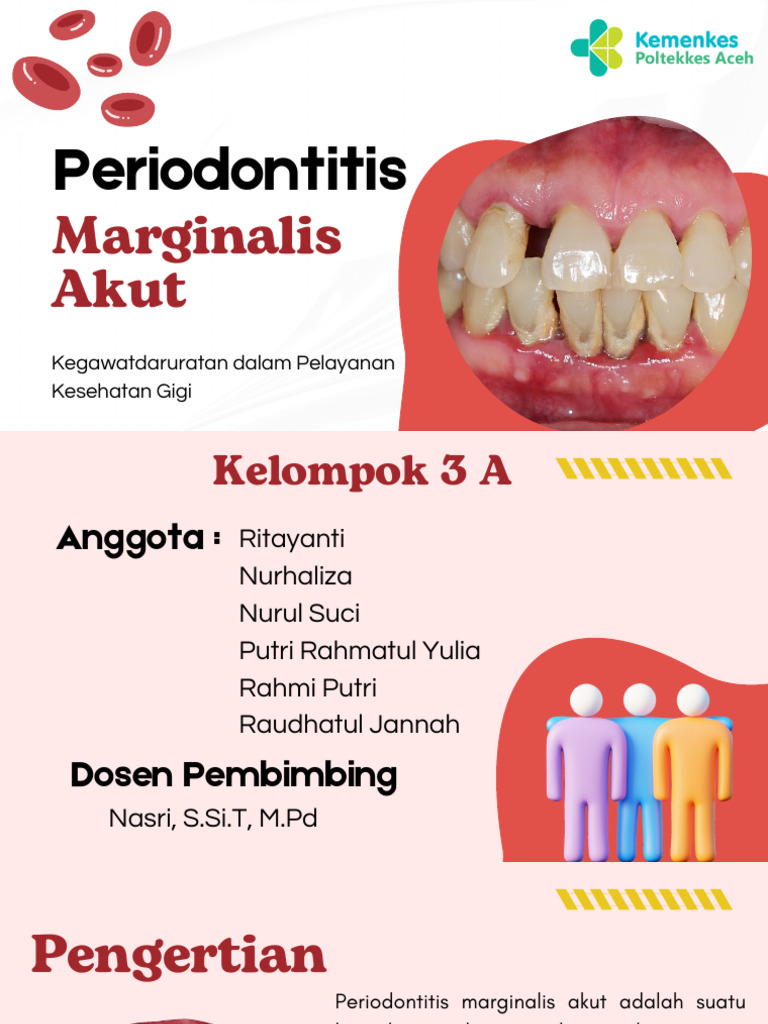 Penanganan Periodontitis Marginalis Akut | PDF