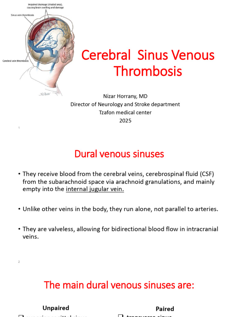 Cerebral Sinus Venous Thrombosis Overview | PDF | Headache | Vein