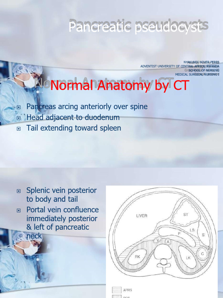 Understanding Pancreatic Pseudocysts | PDF | Pancreas | Pancreatic Cancer