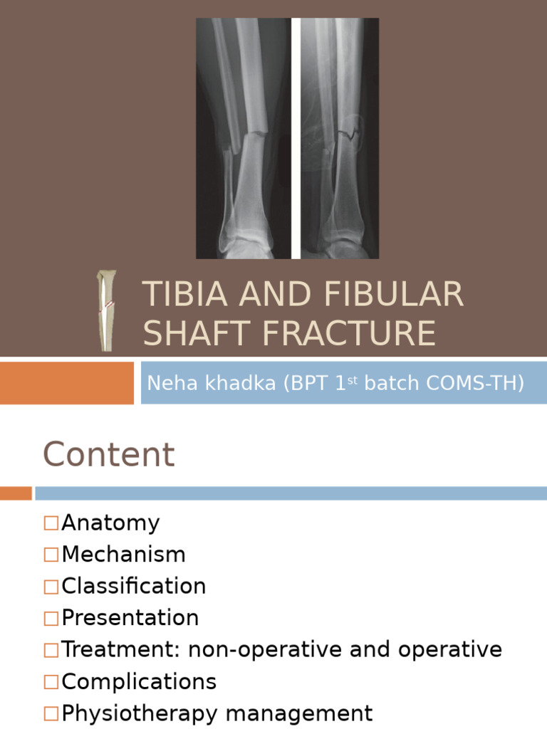 Tibia and Fibular Shaft Fracture | PDF | Knee | Diseases And Disorders