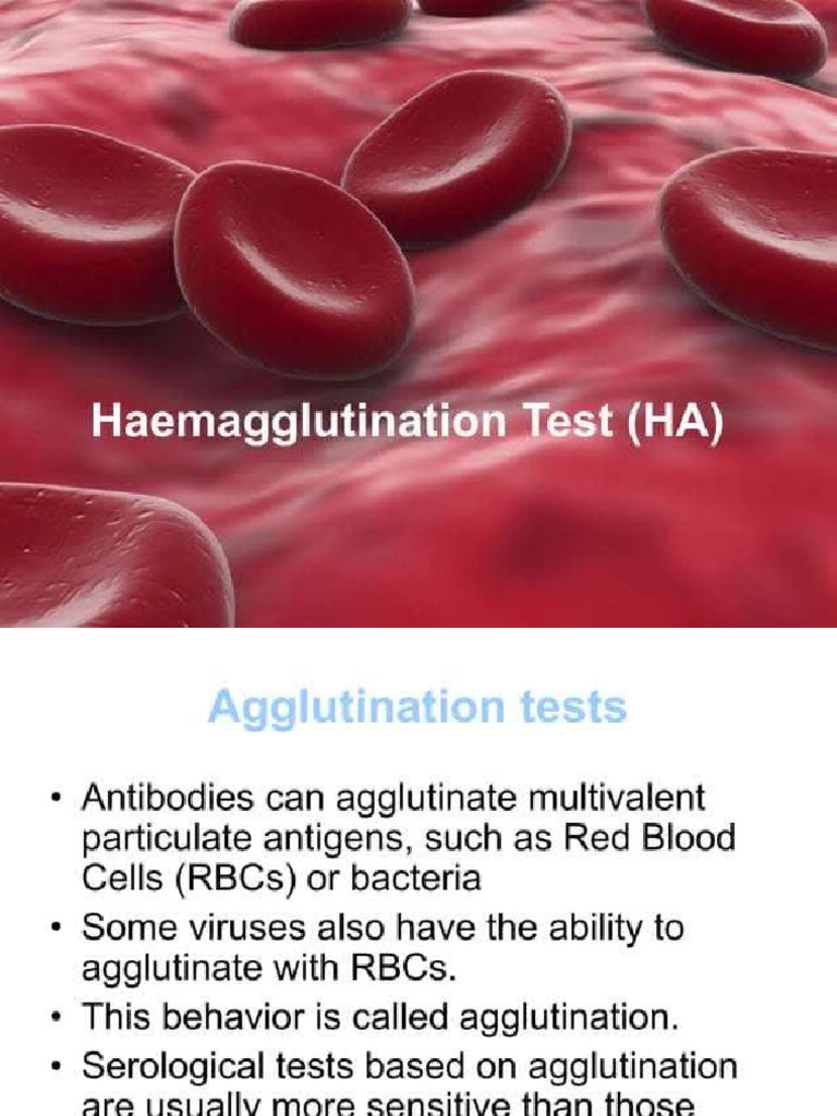 HA Test | PDF