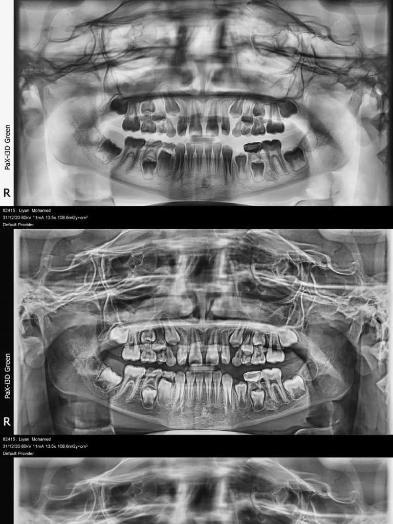 Liyan Moahmed Hfssuydzhydzvjhcxdhbhfdjhc | PDF