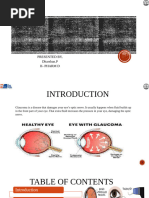Glaucoma ICD-10 Quick Reference 100120 Final | PDF | Glaucoma | Vision