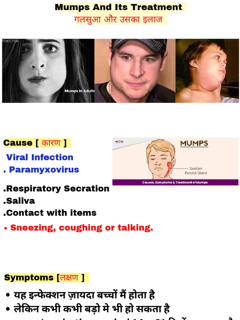 Mumps Medicines | PDF
