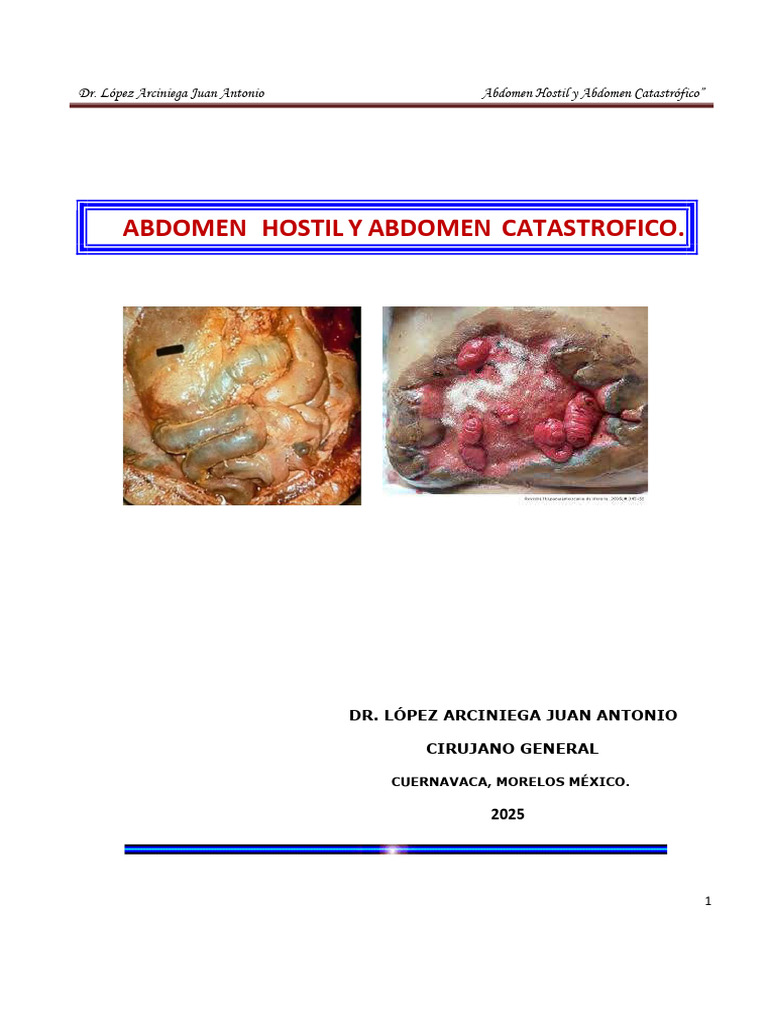 Abdomen Hostil y Abdomen Catastrófico 2025 | PDF | Cirugía | Abdomen