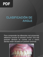 Clasificación de Angle | PDF | Boca | Diente