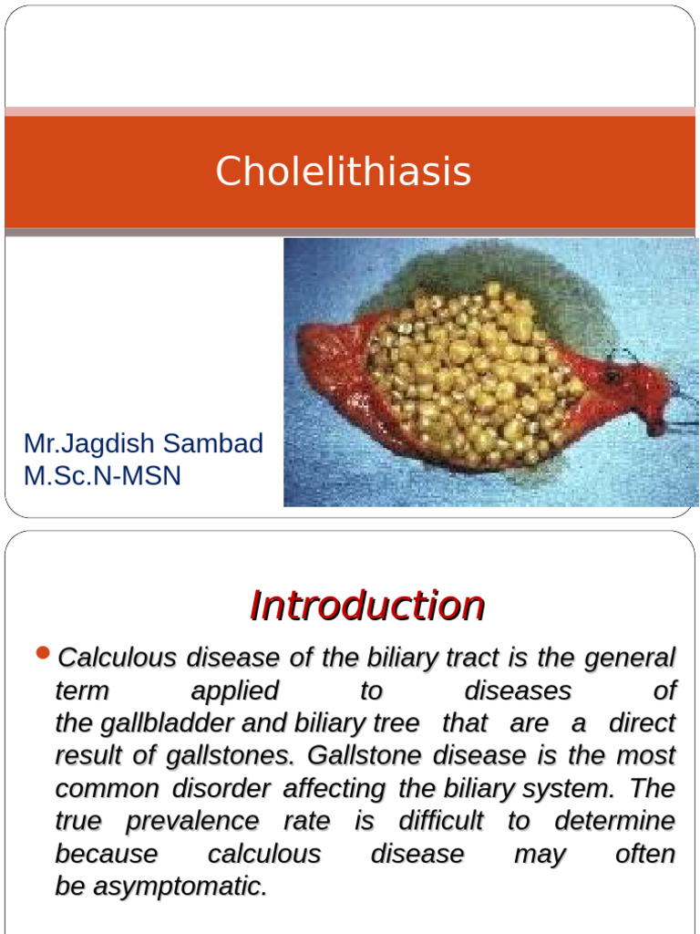 Cholelithiasis 210530121549 | PDF | Gallbladder | Abdomen
