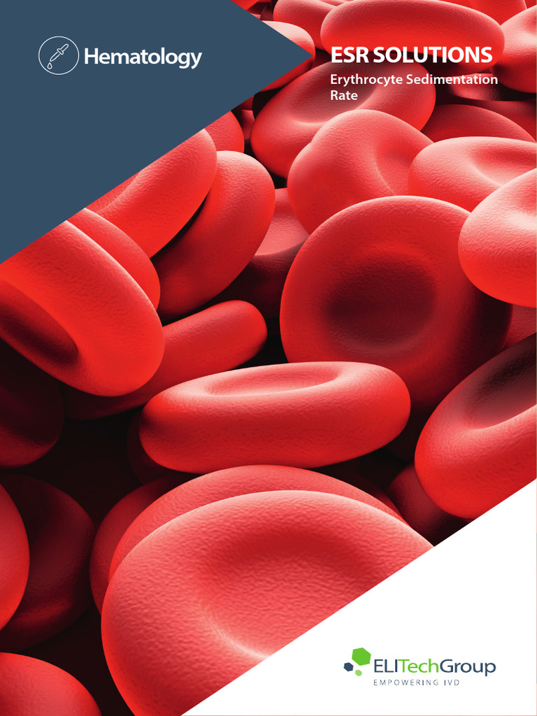 Automated ESR Solutions for Labs | PDF | Image Scanner