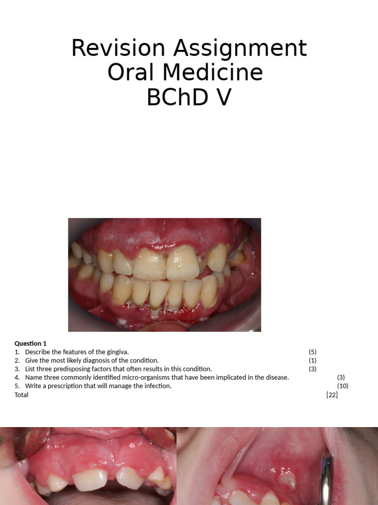 Oral Medicine Revision Questions and Answers | PDF | Medical Diagnosis ...