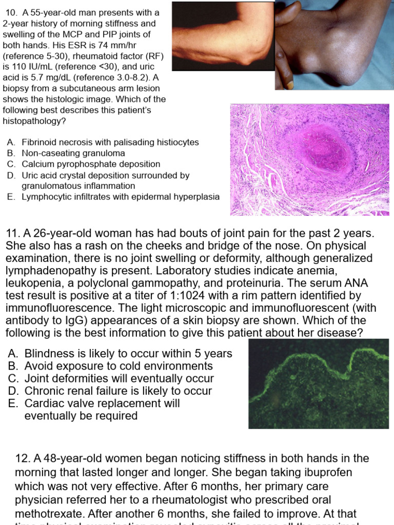 Workshop - Joint Pain - Polyarticular - III | PDF | Clinical Medicine ...