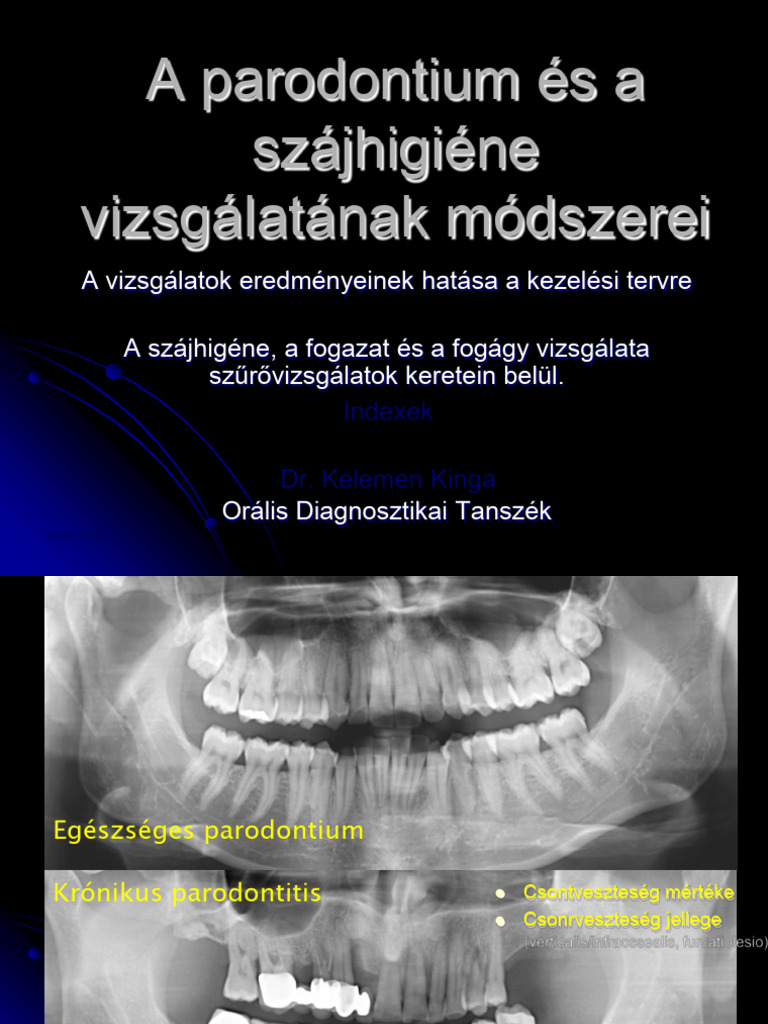 Magyar2015.11.10.EA A Parodontium És A Szájhigiéne Vizsgálata | PDF