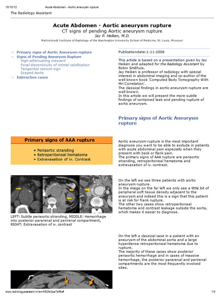 Acute Abdomen - Aortic Aneurysm Rupture | PDF | Aorta | Radiology