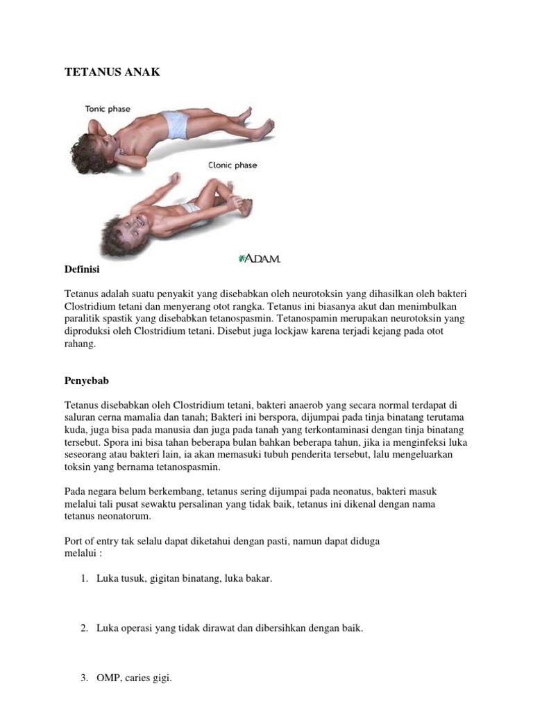 Tetanus Anak | PDF