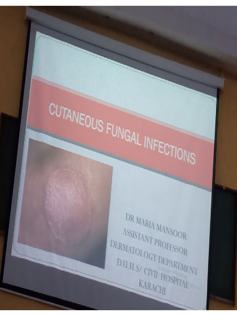 Cutaneous Fungal Infections - PDF 2 | PDF