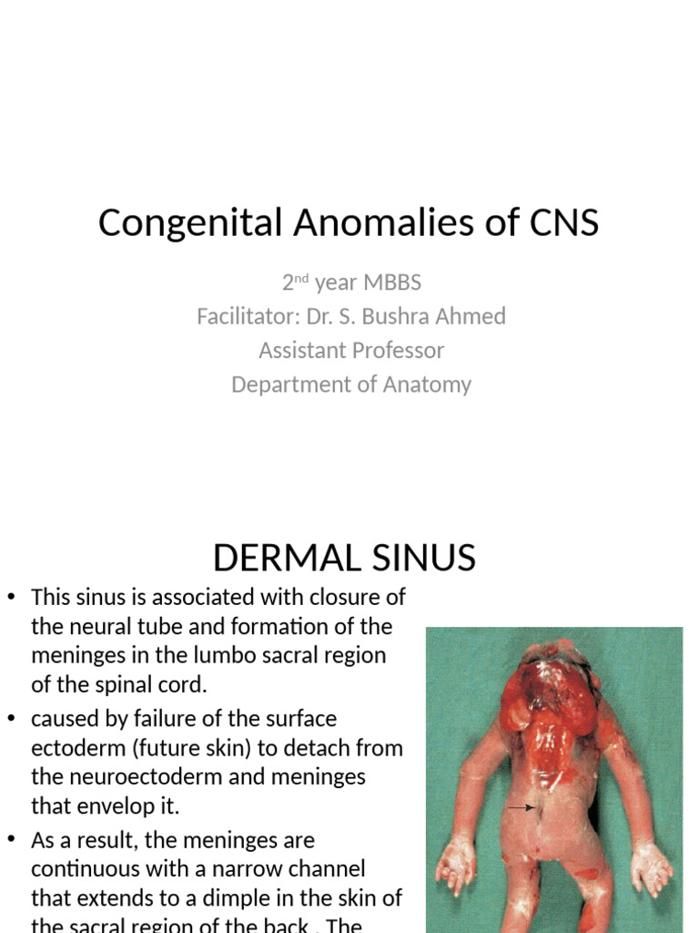 Congenital Anomalies of Cns | PDF | Cerebrospinal Fluid | Vertebra