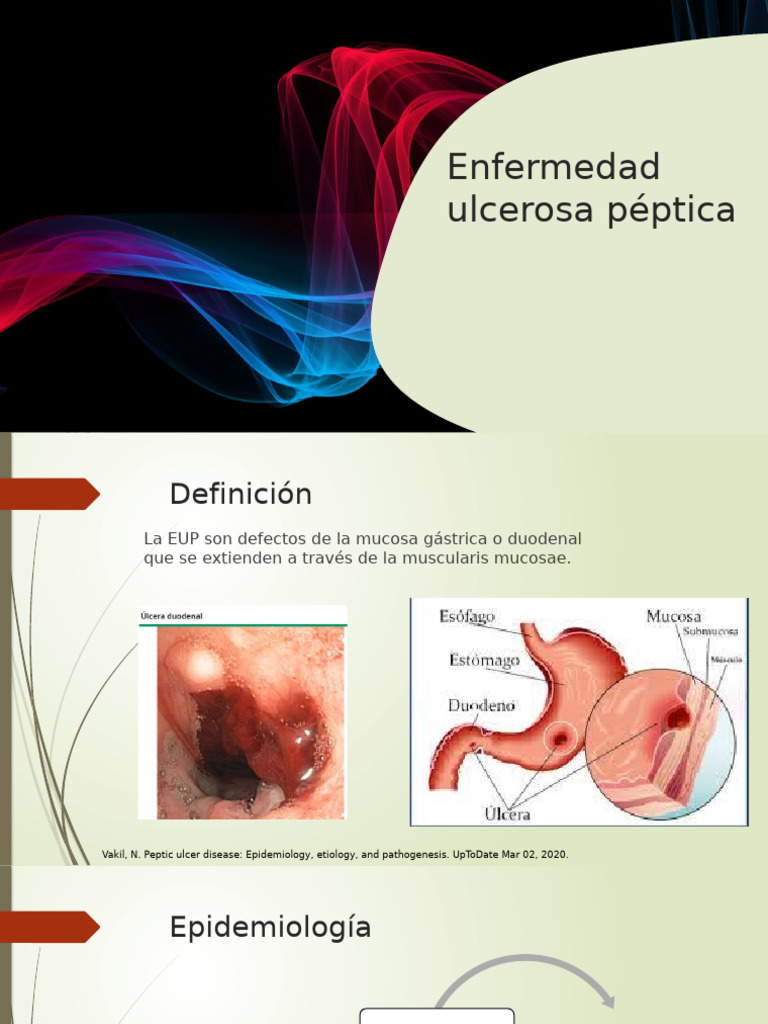 Ulcera Peptica | PDF | Droga anti-inflamatoria libre de esteroides ...