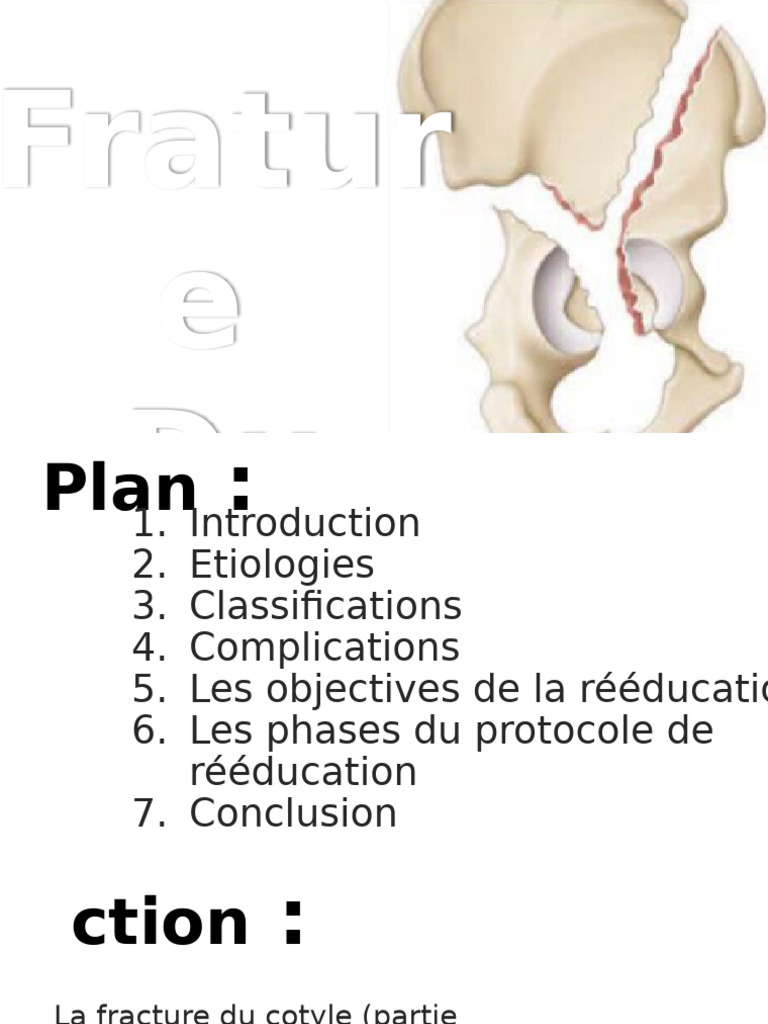 Fracture de Cotyle | PDF | Appareil locomoteur | Maladies et troubles