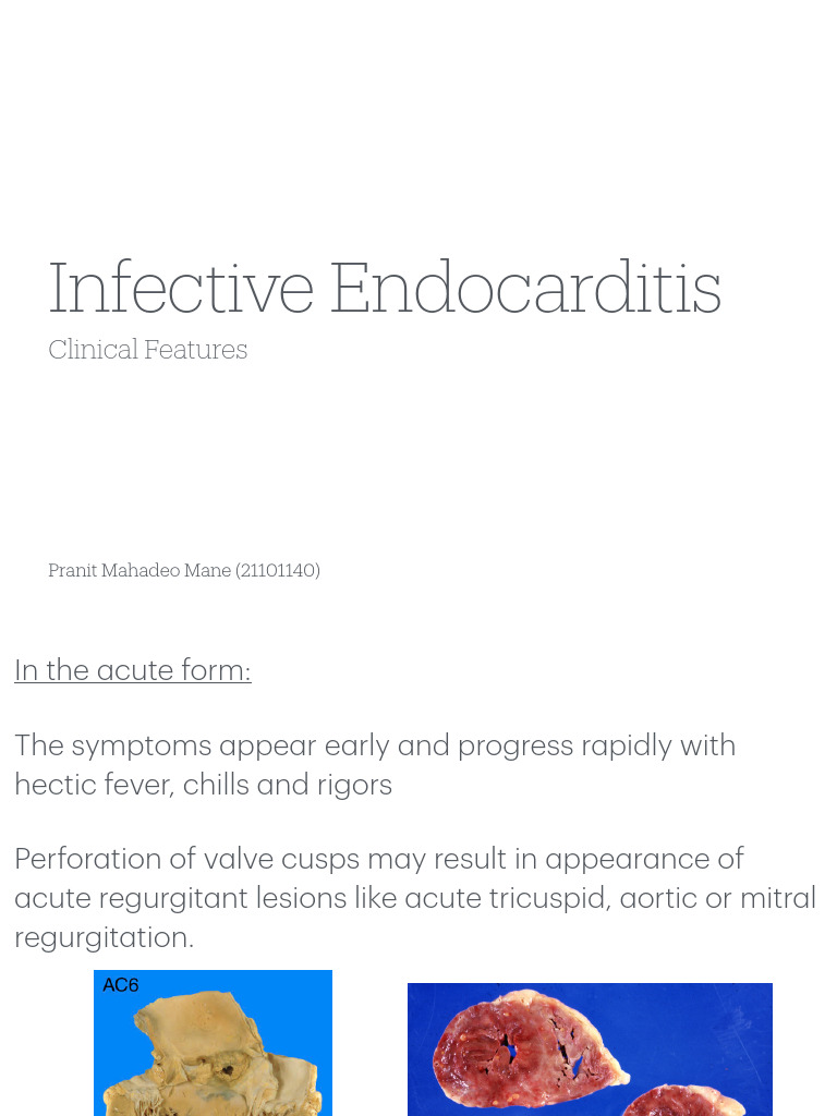 Infective Endocarditis | PDF | Diseases And Disorders