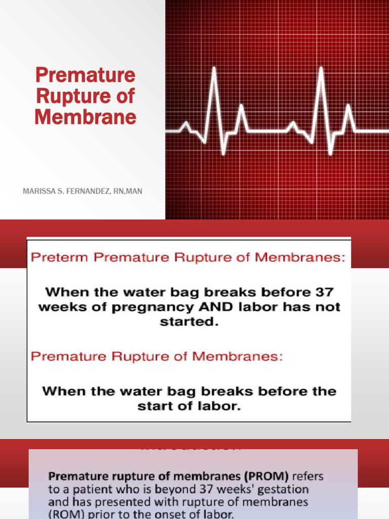 Understanding Premature Rupture of Membranes | PDF