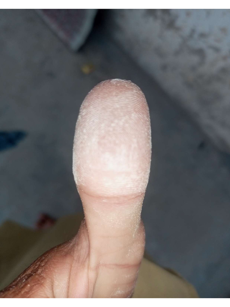 Img 20250602 054519 788 | PDF