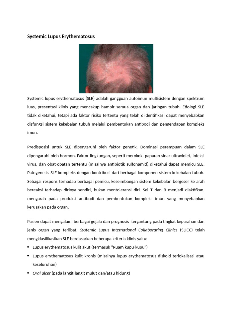 Health Article Systemic Lupus Erythematosus | PDF