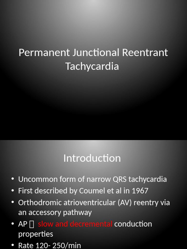 Understanding Permanent Junctional Reentrant Tachycardia | PDF ...