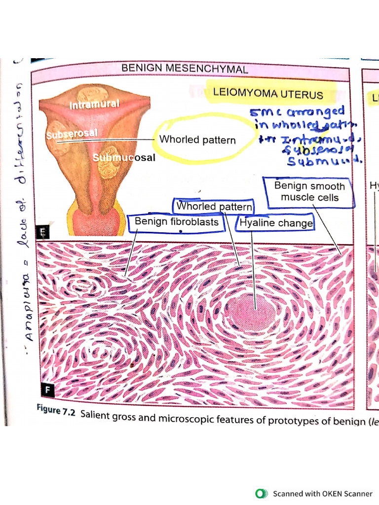 Pathology Slides Explaination | PDF