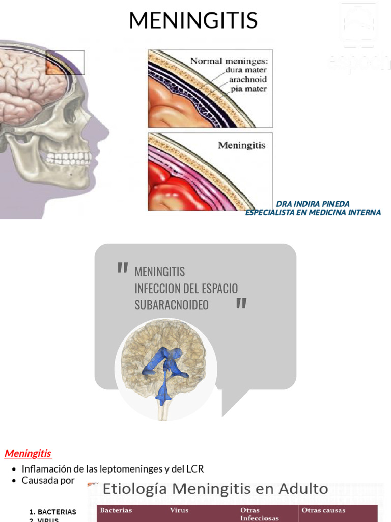 0 18. Meningitis | PDF | Meningitis | Inmunología