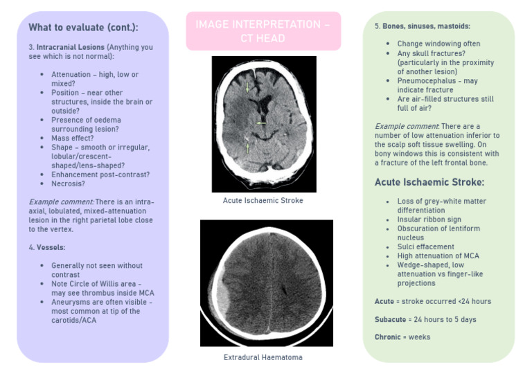 CT Head Poster 2 | PDF | Diseases And Disorders | Medical Specialties