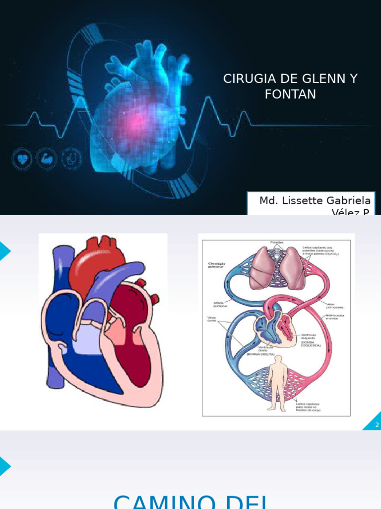 Cirugía de Glenn y Fontan: Procedimientos Clave | PDF | Corazón ...