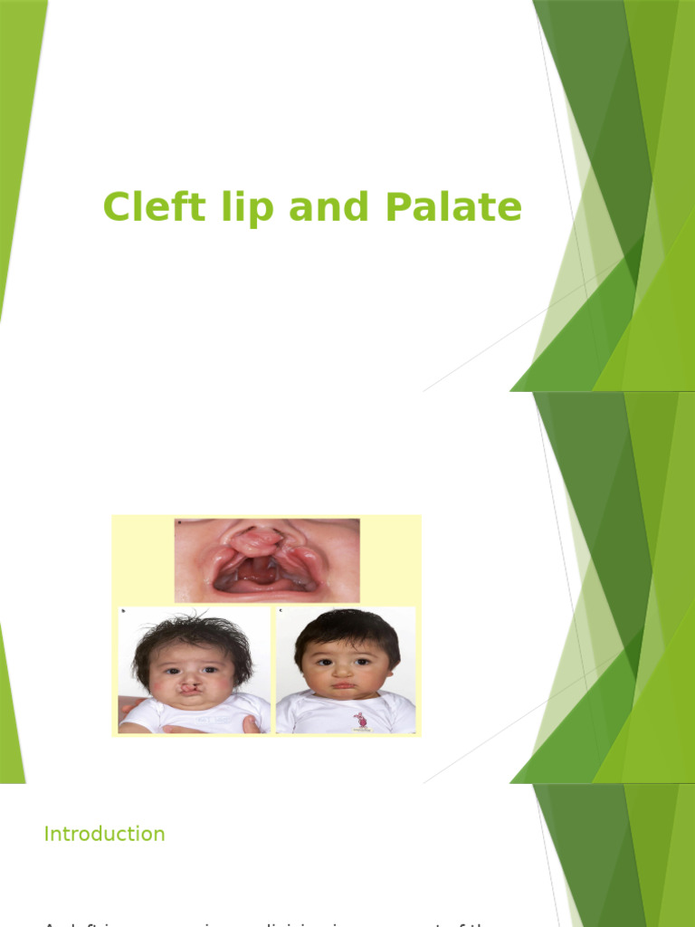 Cleft Lip and Palate Management | PDF | Diseases And Disorders | Medical Specialties