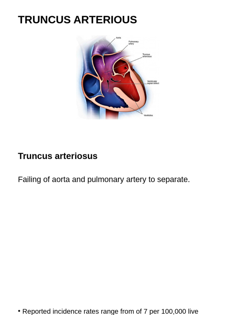 Truncus Arterious | PDF