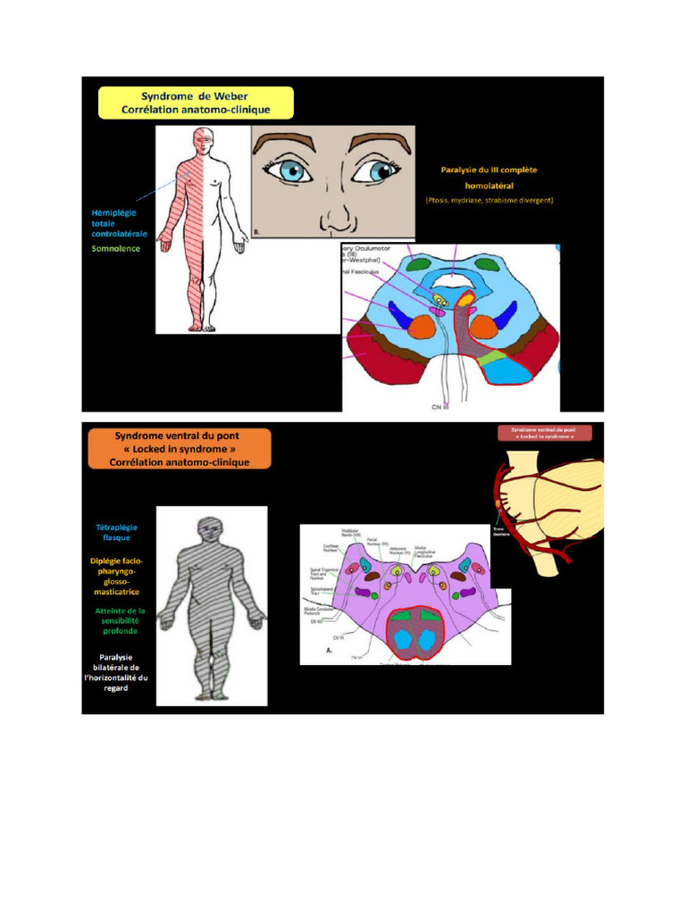 AVC A Imprimer | PDF