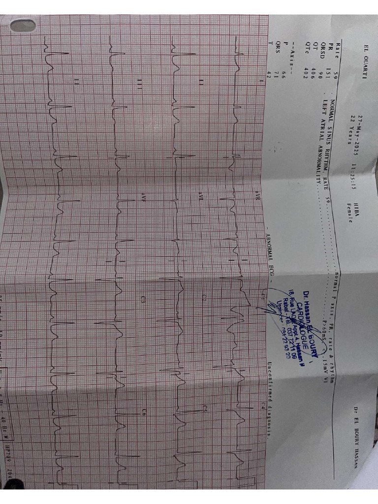 Ecg | PDF