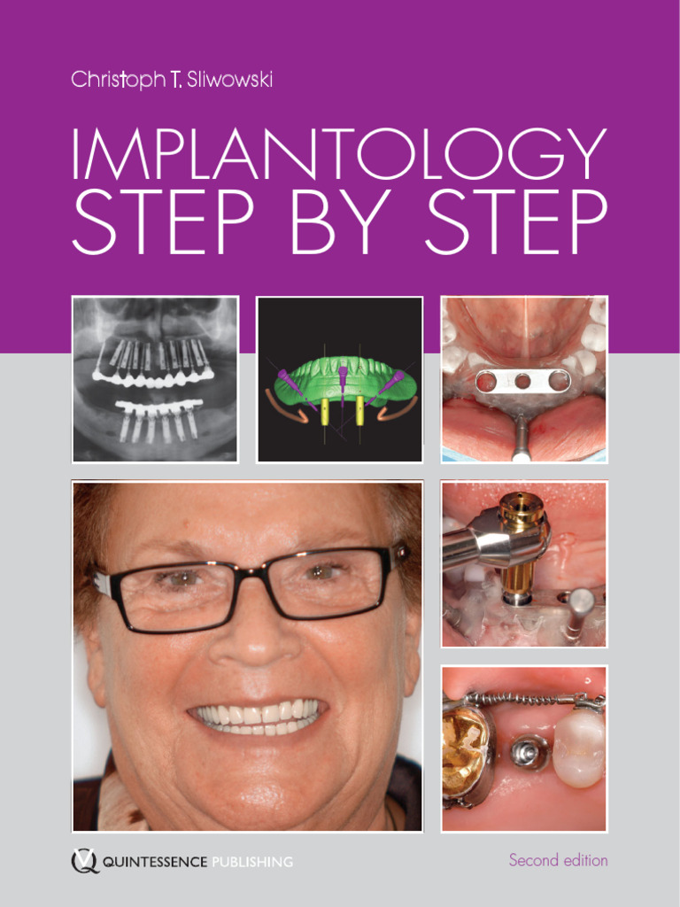 Leseprobe 18121 Sliwowsk | PDF | Dental Implant | Prosthesis