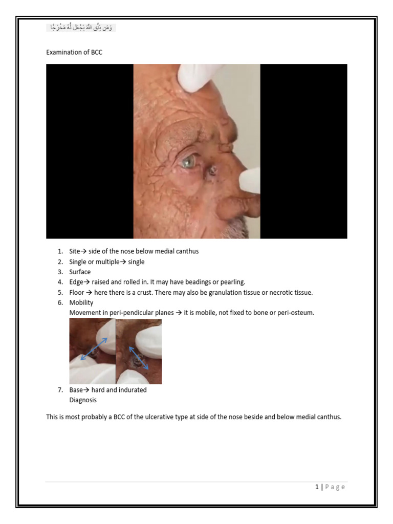 Clinical Examination of BCC | PDF