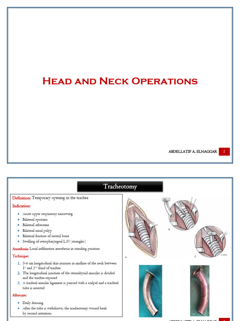 Head and Neck Surgical Procedures Guide | PDF | Abdomen | Surgical Suture