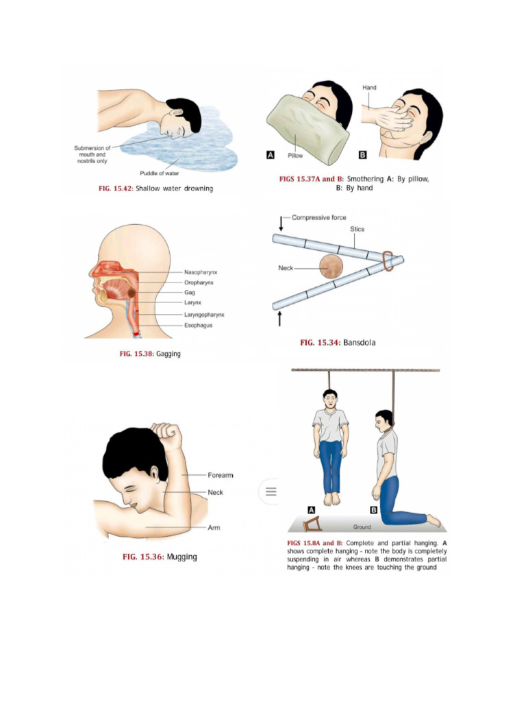 Chot I Project | PDF