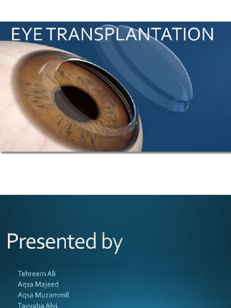 Eye Transplantation | PDF
