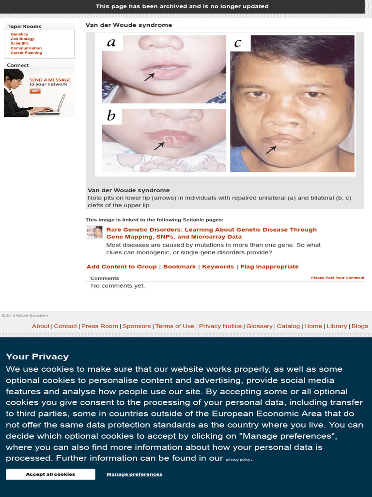 Van Der Woude Syndrome Learn Science at Scitable | PDF