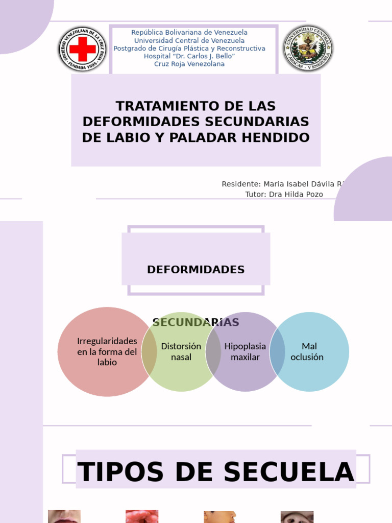 Tto Deformidades Secundarias | PDF | Ortodoncia | Especialidades Medicas