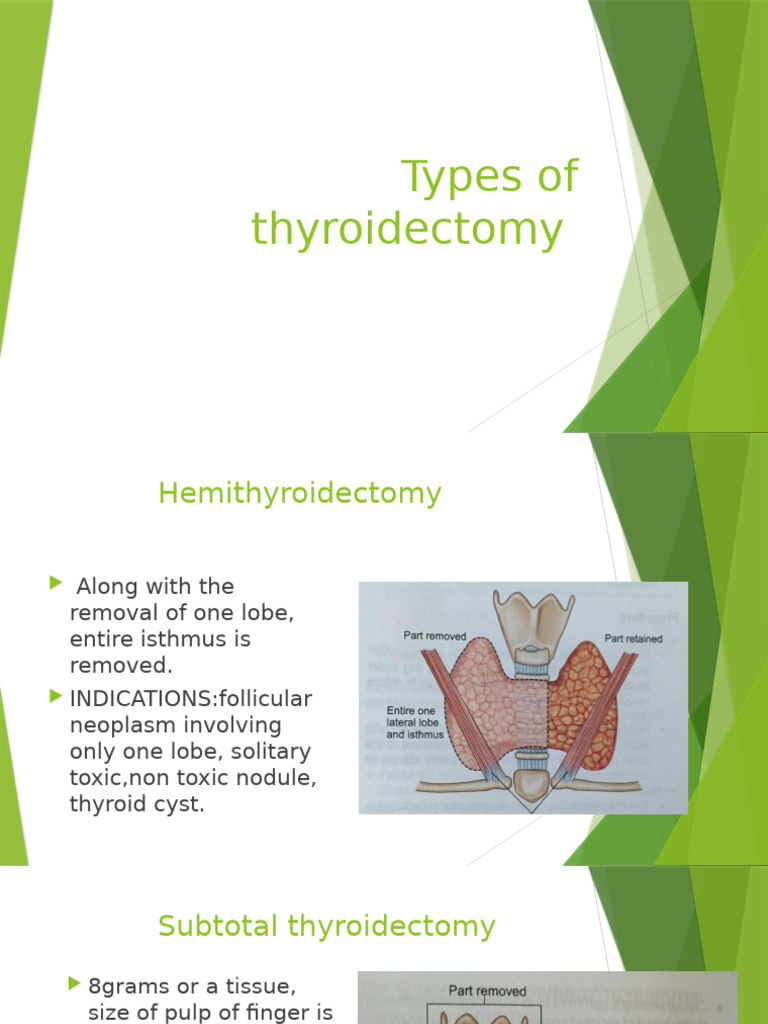 Types of Thyroidectomy | PDF