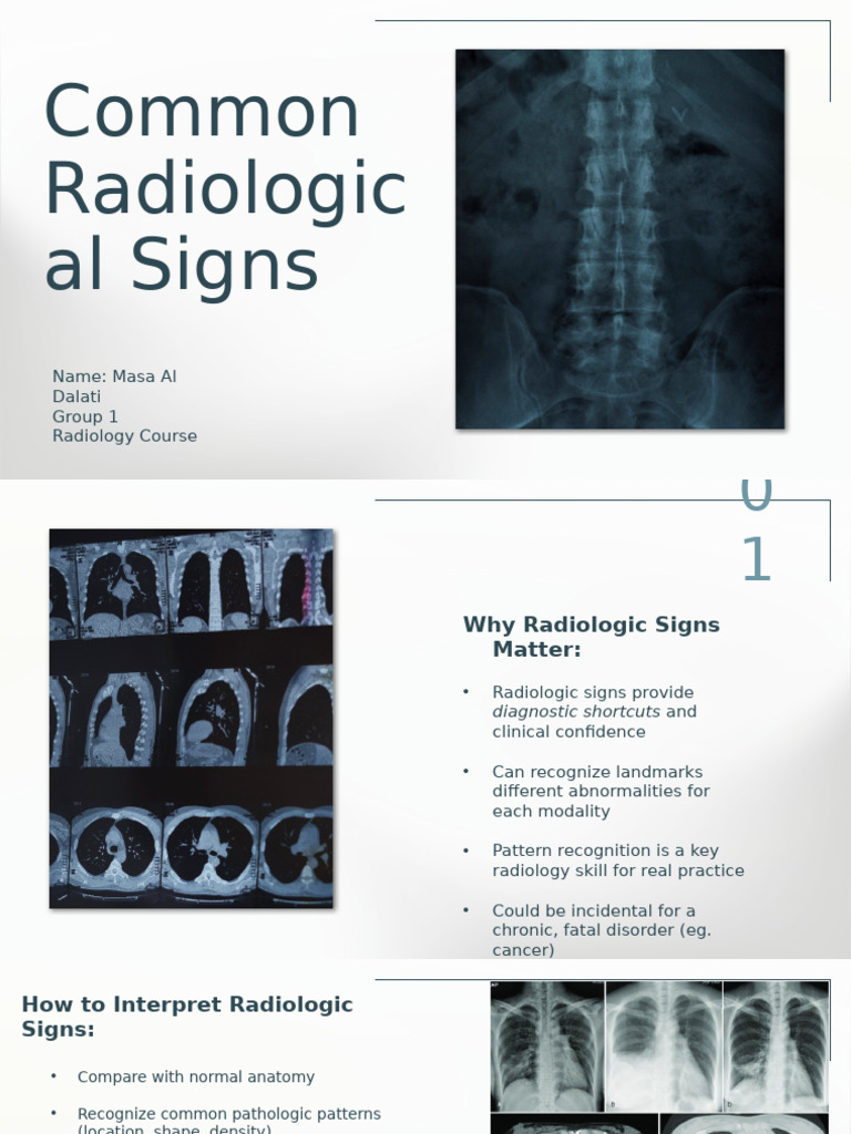 Common Radiological Signs | PDF | Radiology | Medical Specialties