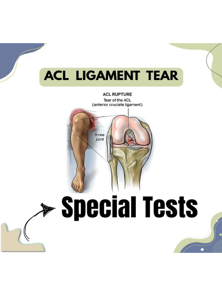 Tests For ACL LIGAMENT TEAR | PDF